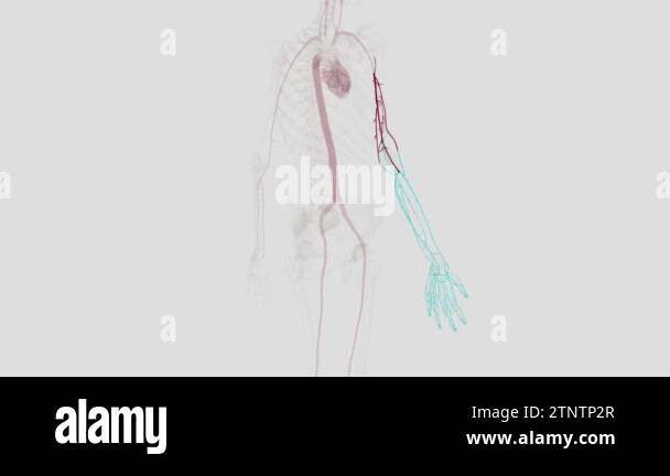 The major arteries of the upper limb are: the subclavian artery, the ...
