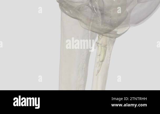 The proximal phalanx of the fingers is the proximal, or first bone, in ...