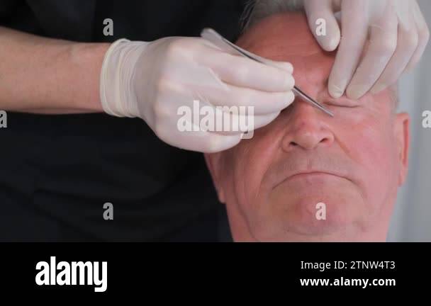 Close-up of a mans face during examination by a plastic surgeon ...