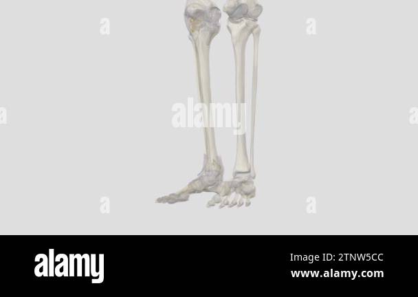 The inferior tibiofibular joint, also known as the distal tibiofibular ...