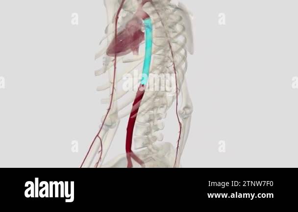 An abdominal aortic aneurysm is an enlarged area in the lower part of ...