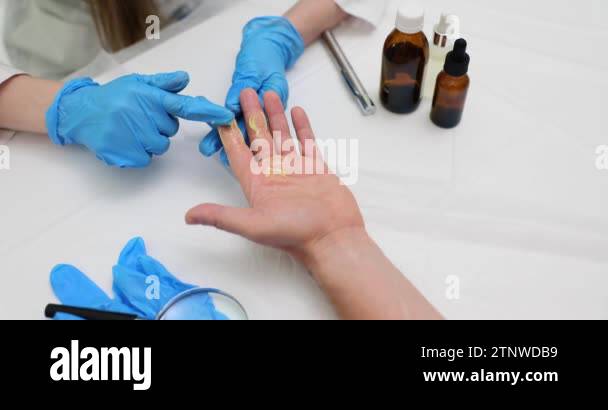 Sore finger Stock Videos & Footage - HD and 4K Video Clips - Alamy