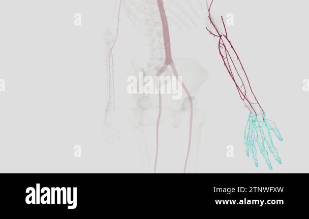 Forearm. Radial Artery The radial artery is one of two major blood ...