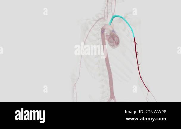 The brachial artery is the extension of the axillary artery starting at ...