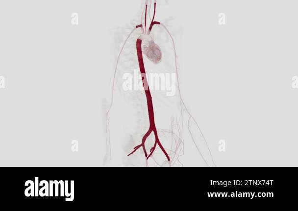 The largest artery in the body is the aorta and it is divided into four ...