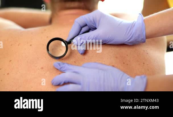 Malignant man Stock Videos & Footage - HD and 4K Video Clips - Alamy