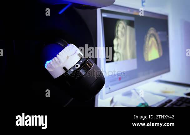 Dental prosthetic restoration. Denturist is making 3D model for ...