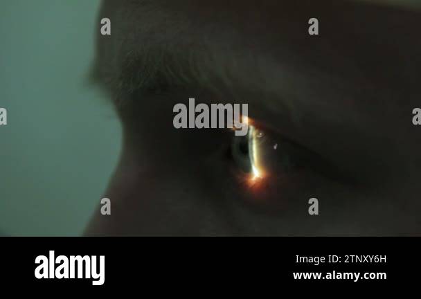 Scanning the retina among men with blue eyes special ophthalmic device ...