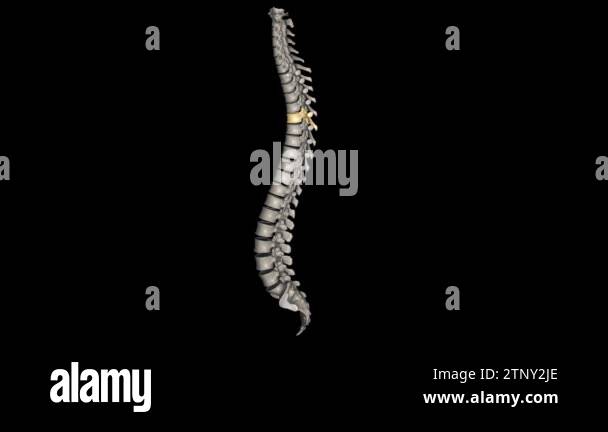 Thoracic Vertebral, T5 Twelve vertebrae are located in the thoracic ...