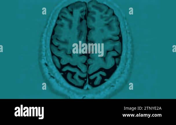 Brain time Stock Videos & Footage - HD and 4K Video Clips - Alamy