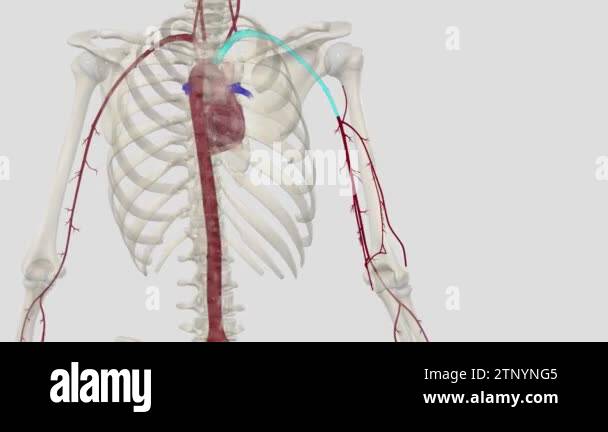 The major arteries of the upper limb are: the subclavian artery, the ...