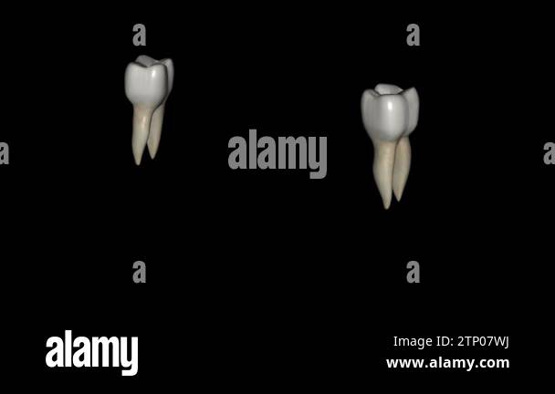 The mandibular second molar resembles the mandibular first permanent ...