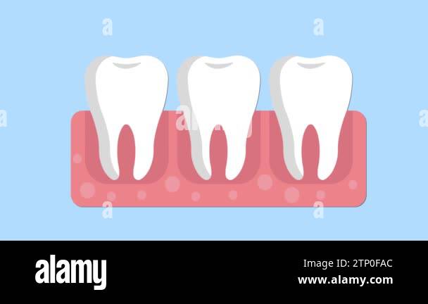 Dentist checking germs in teeth poor oral hygiene animation Stock Video ...