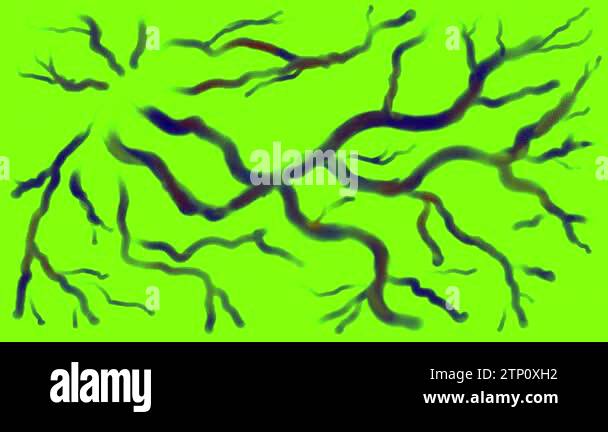Pulsating cartoon veins on a green screen. Effect of disease ...