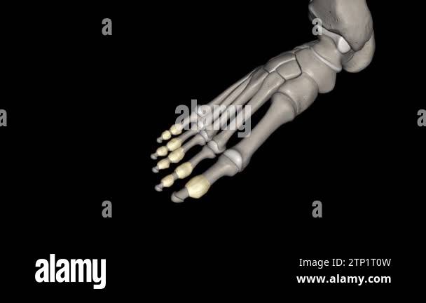 The interphalangeal joints of the foot are between the phalanx bones of ...