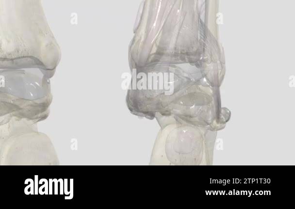 Each metatarsophalangeal joint is enclosed by a loose joint capsule ...