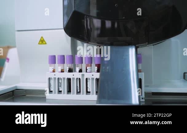 Professional medical device making human blood analysis, Racks for ...
