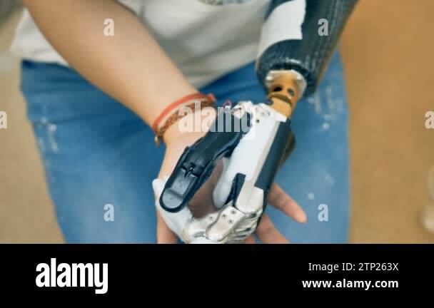 Female using wireless bionic prosthesis for the first time. Robotic ...