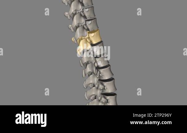 Thoracic Vertebral, T10 Twelve vertebrae are located in the thoracic ...