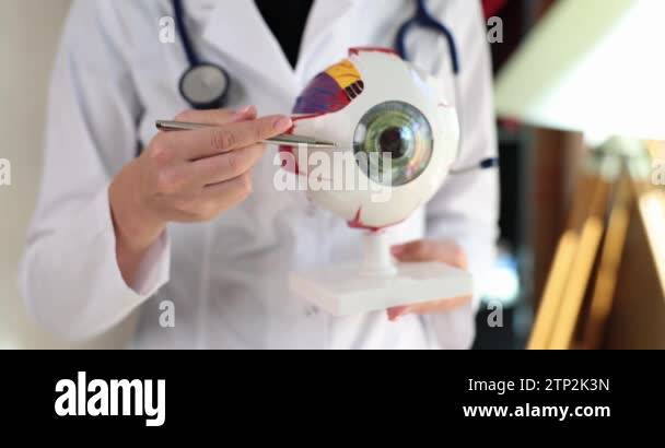 Doctor ophthalmologist showing disease on artificial model of human eye ...