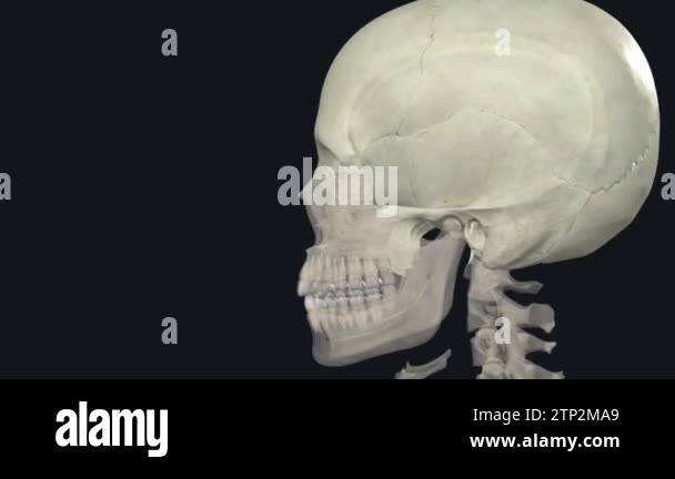 Neurocranium as a whole bone complex. See multiple interactive high ...