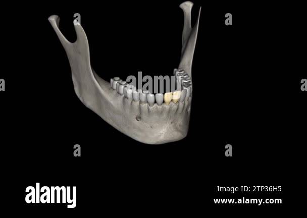 The mandibular central incisor is the tooth located on the jaw ...