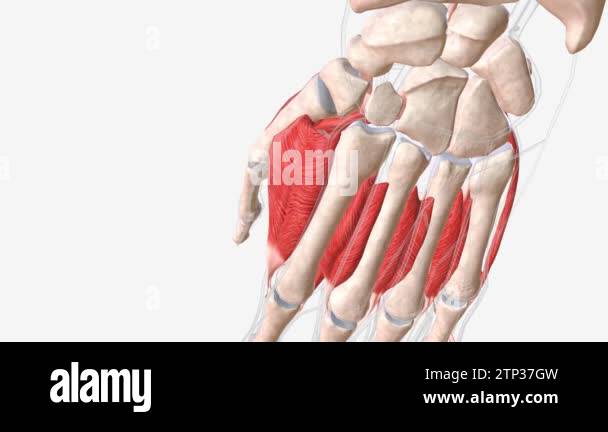 The dorsal interossei muscles are situated within the dorsal ...