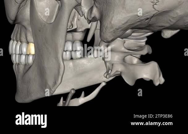 The maxillary second molar is the tooth located distally from both the ...