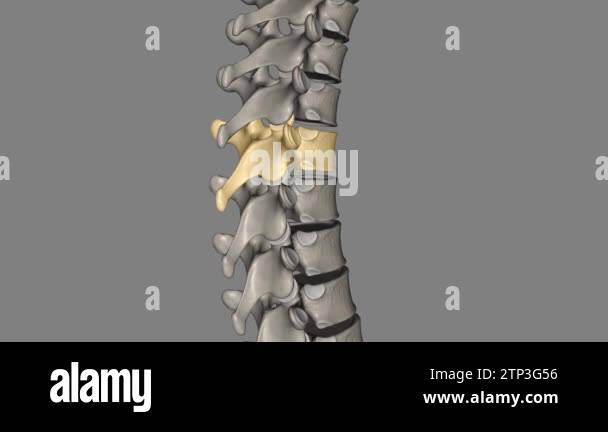 Thoracic Vertebral, T5 Twelve vertebrae are located in the thoracic ...