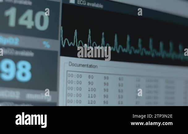 Close-up view of the screen of patient monitor displays vital signs ECG ...