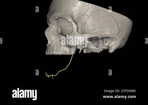 The marginal mandibular branch of the facial nerve arises from the ...