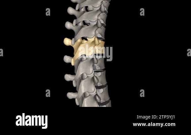 Thoracic Vertebral, T5 Twelve vertebrae are located in the thoracic ...