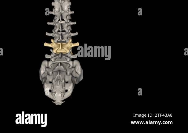 The L4 and L5 are the lowest vertebrae, or spinal bones, in the lumbar ...