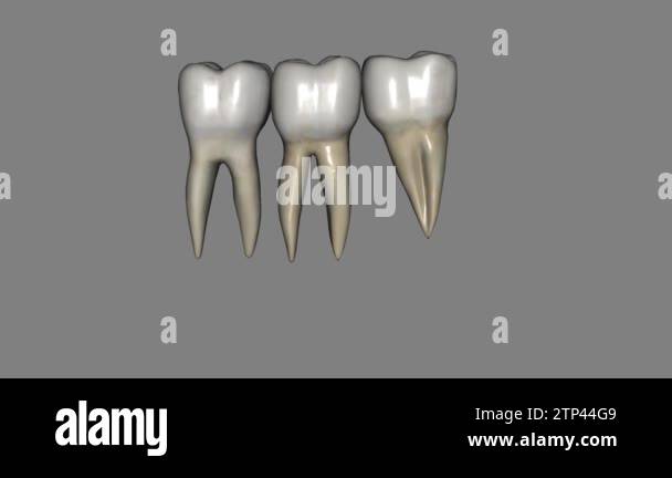 The mandibular first molar usually has two roots, a mesial and a distal Stock Video Footage - Alamy