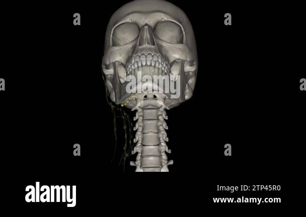The submandibular lymph nodes are some 3-6 lymph nodes situated at the ...