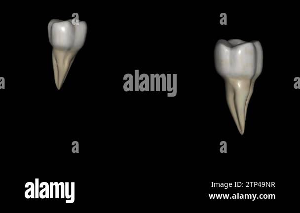 The mandibular third molar is also referred as the wisdom tooth Stock ...