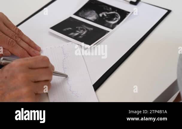 Cardiotocography Stock Videos & Footage - HD and 4K Video Clips - Alamy