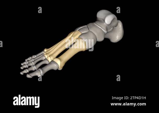 The metatarsal bones are the bones of the forefoot that connect the ...