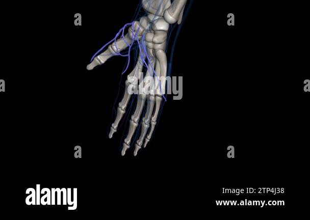 The superficial palmar venous arch consists of a pair of venae ...