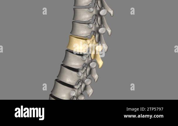 Thoracic Vertebral, T8 Twelve vertebrae are located in the thoracic ...