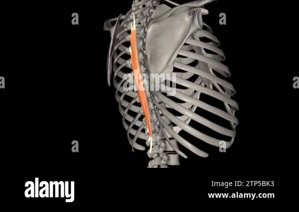 Spinalis Thoracis belongs to the medial column of the erector spinae ...
