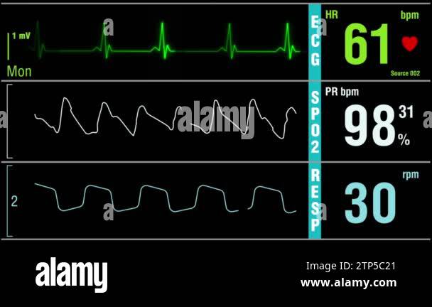 Heart rate, pressure rate, oxygen saturation, respiration indication ...