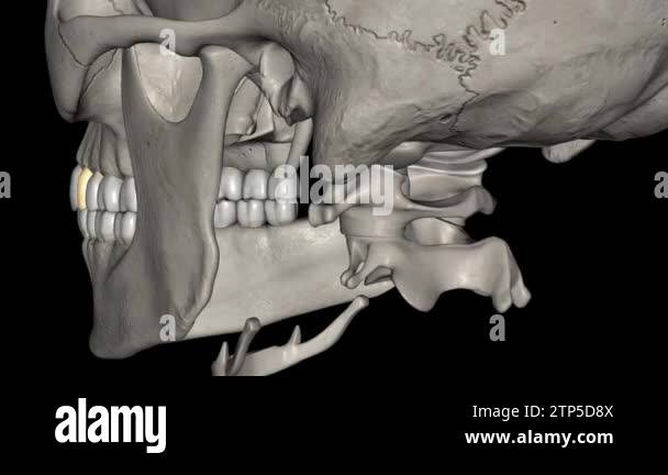 The mandibular first premolar has a bulkier crown compared to the ...