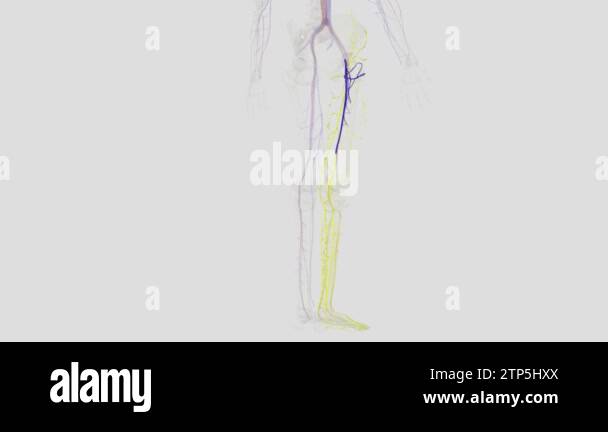 The deep femoral vein, deep vein of the thigh or profunda femoris vein ...