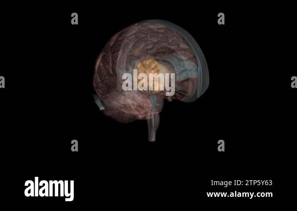 The forebrain structures include the caudate nucleus, the putamen, the ...