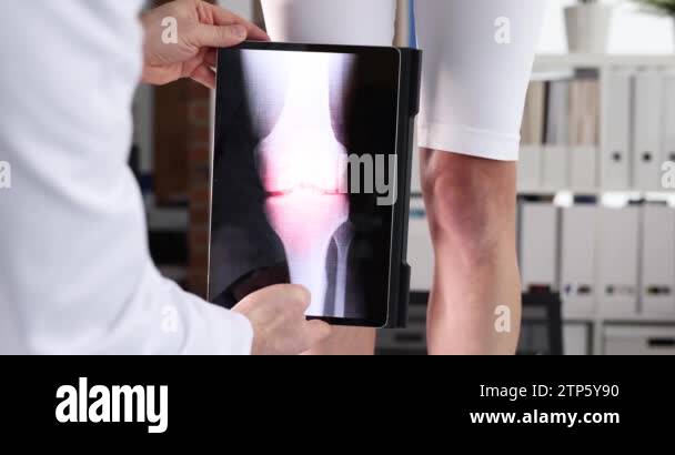 Doctor doing computer examination of knee joint using digital tablet 4k ...