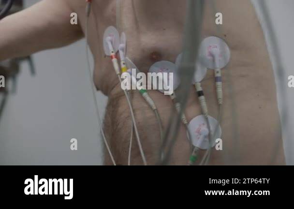 Elderly man with holter sensors pedals orbitrek in cardiology room ... Elderly man with holter sensors pedals orbitrek in cardiology room ...