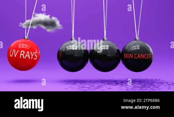 Uv rays leads to skin cancer. A Newton cradle metaphor in which uv rays ...