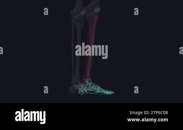 Anterior Tibial Artery