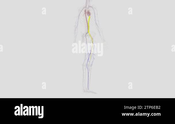 The great saphenous vein is a large venous blood vessel running near ...